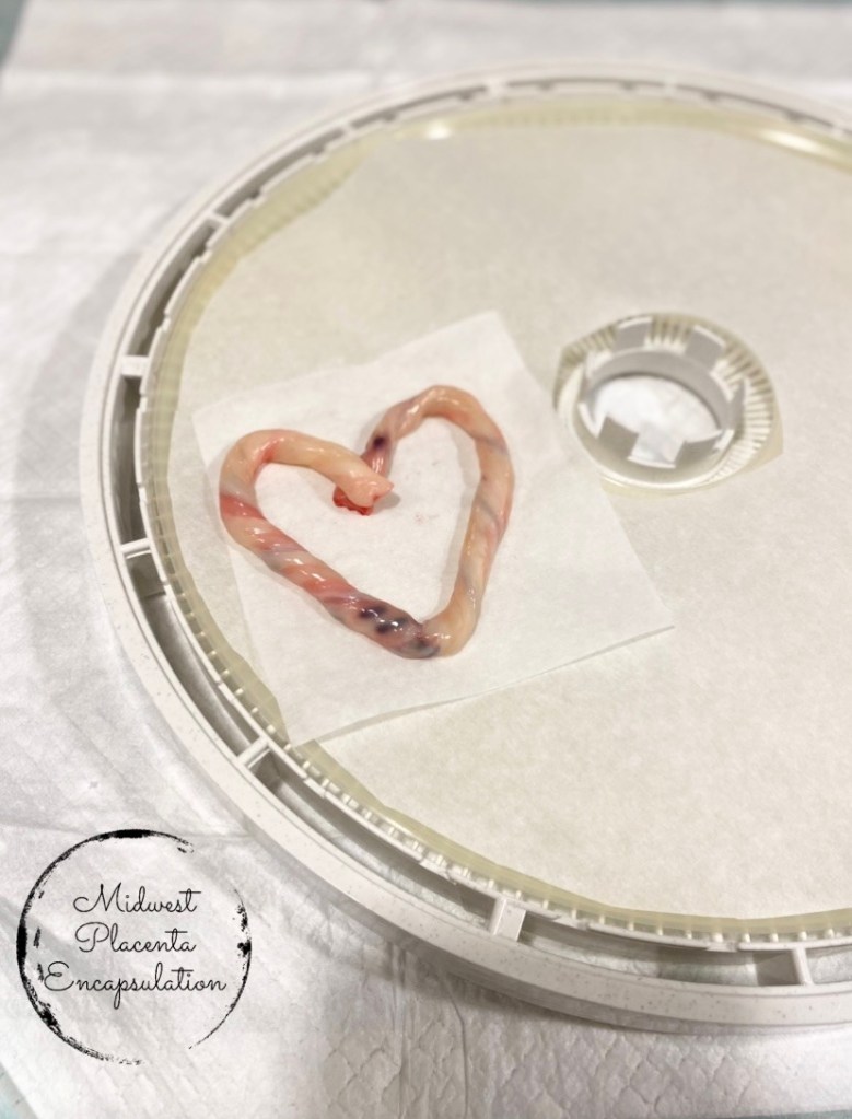Step-By-Step Photo Gallery – Midwest Placenta Encapsulation