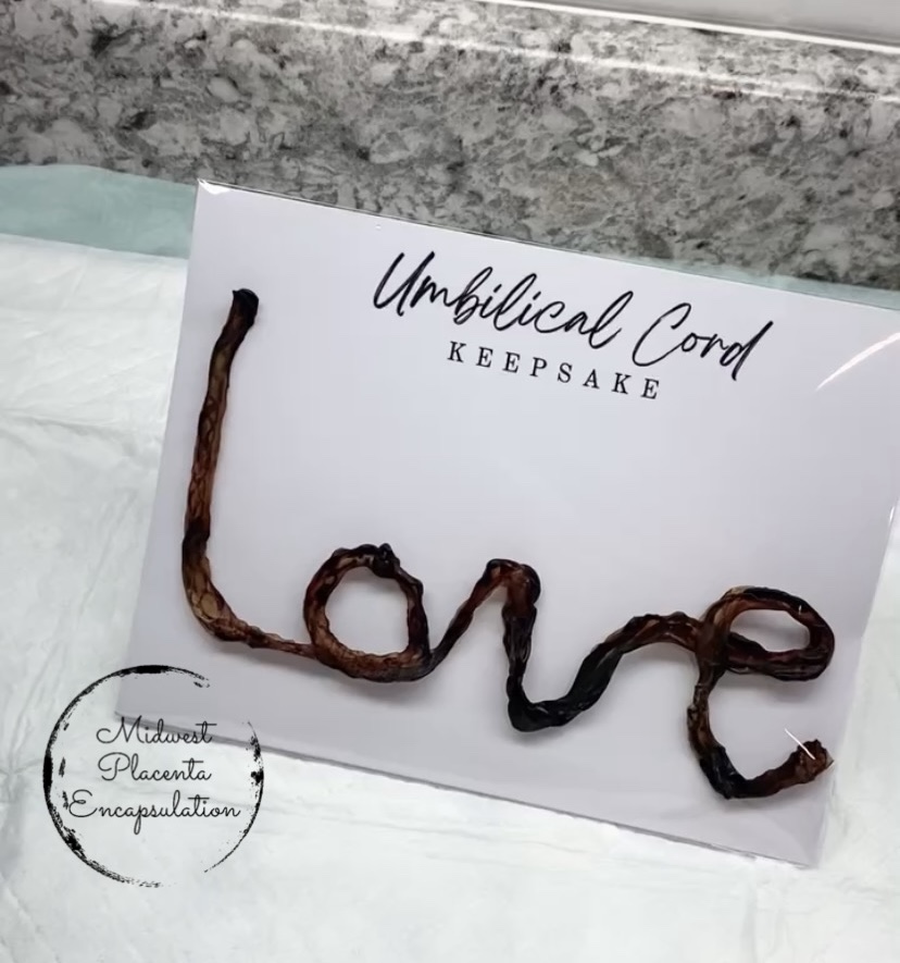 Keepsake Items – Midwest Placenta Encapsulation