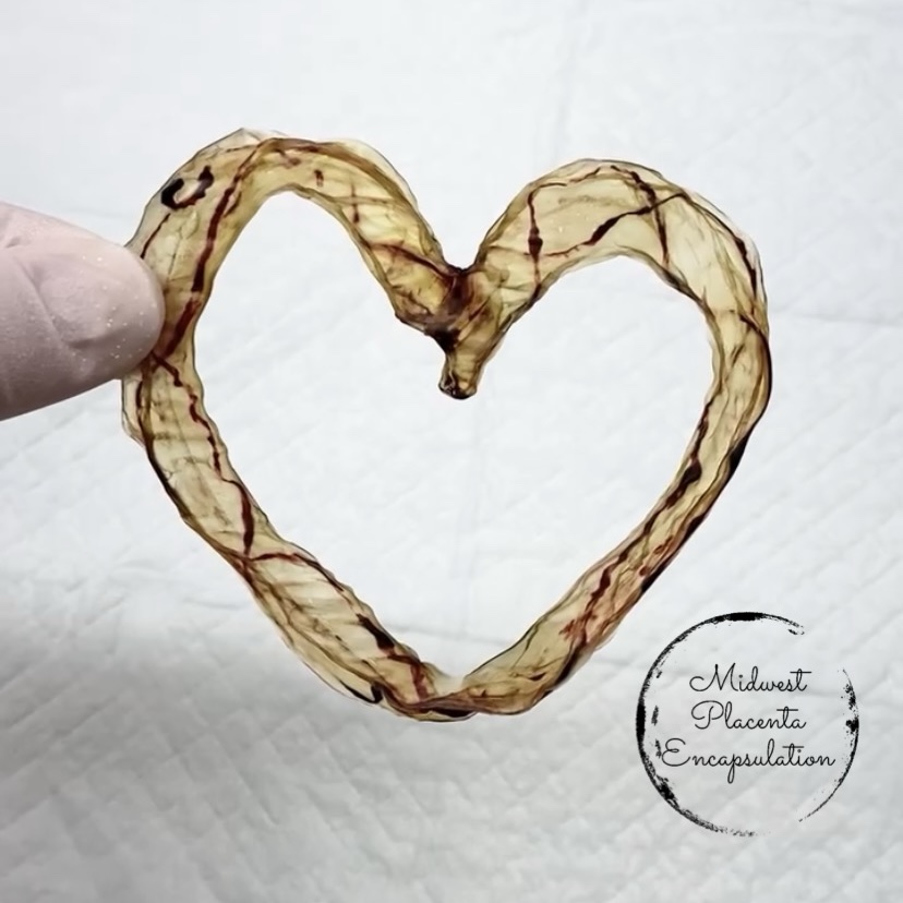 Keepsake Items – Midwest Placenta Encapsulation